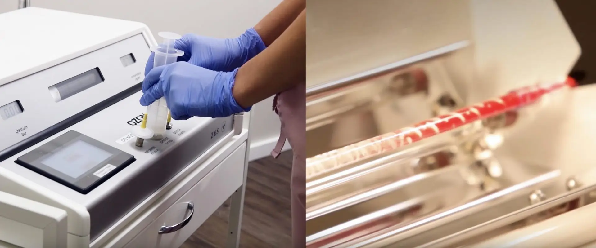 Exploring IV UV with Ozone: A Powerful Duo for Health and Healing ...